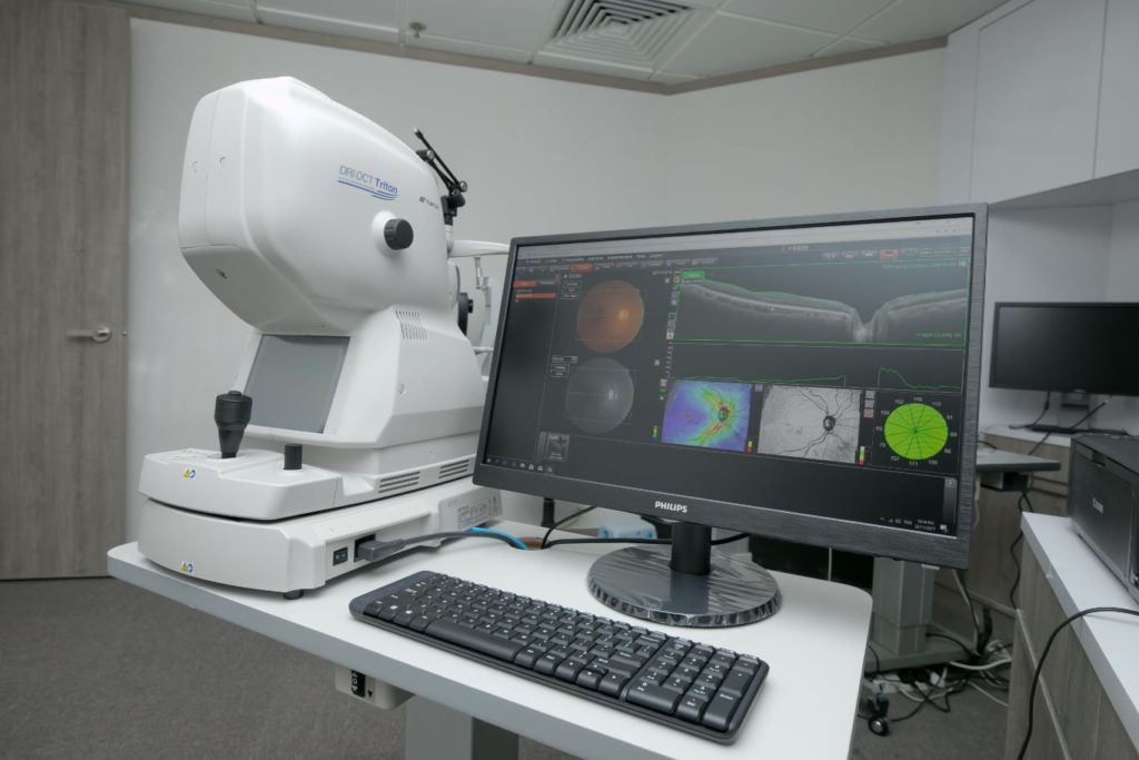 Optical Coherence Tomography (Swept Source) - Vision Care